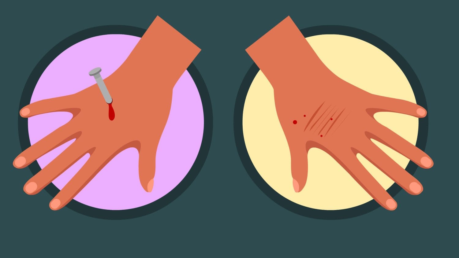 Basic First Aid: Caring for an Open Wound – Toolbox Talk - eSafety